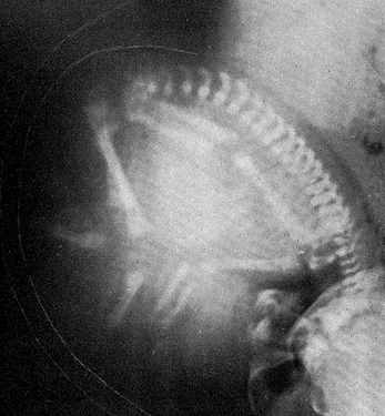 How the hidden contents of the womb became visible | New Scientist