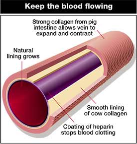 Fake veins deliver the heart's desire | New Scientist