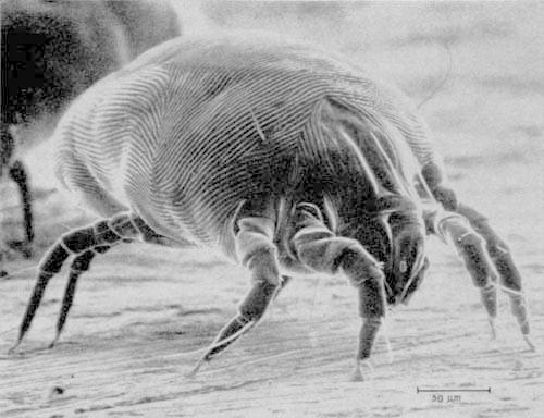 Dust mite droppings damage skin's defences | New Scientist