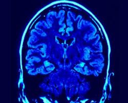 The outer limits of the human brain | New Scientist