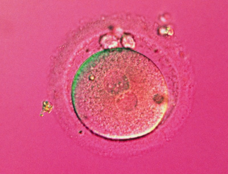 Genetic test screens embryo without disturbing it | New Scientist