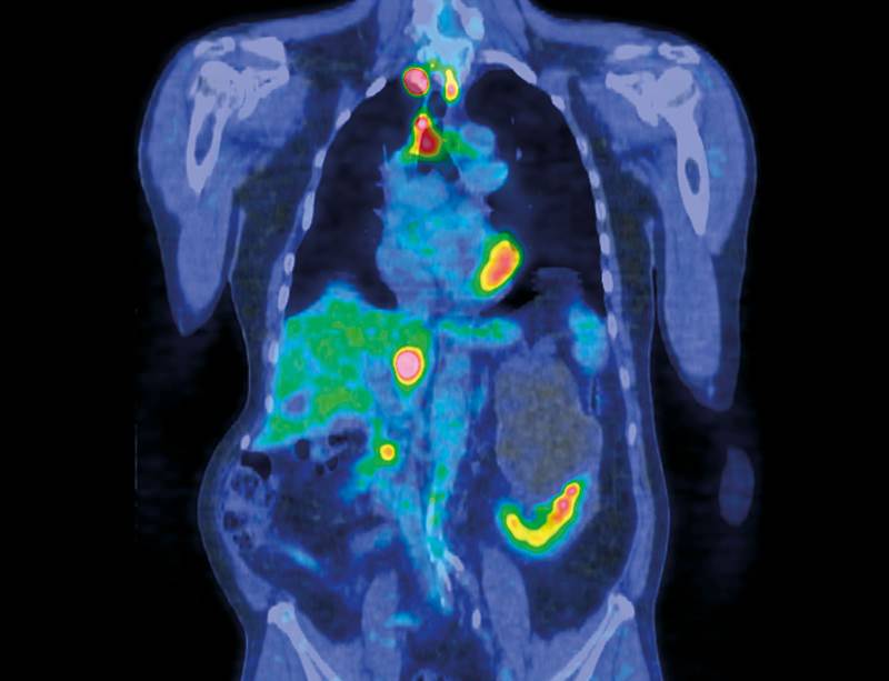 Giant leaps of evolution make cancer cells deadly | New Scientist