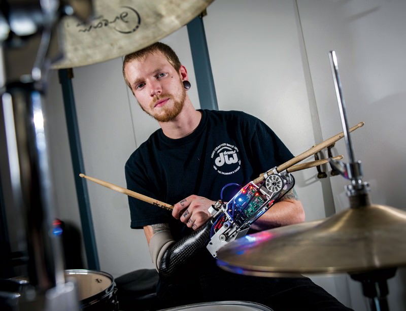 Bionic arm gives cyborg drummer superhuman skills | New Scientist