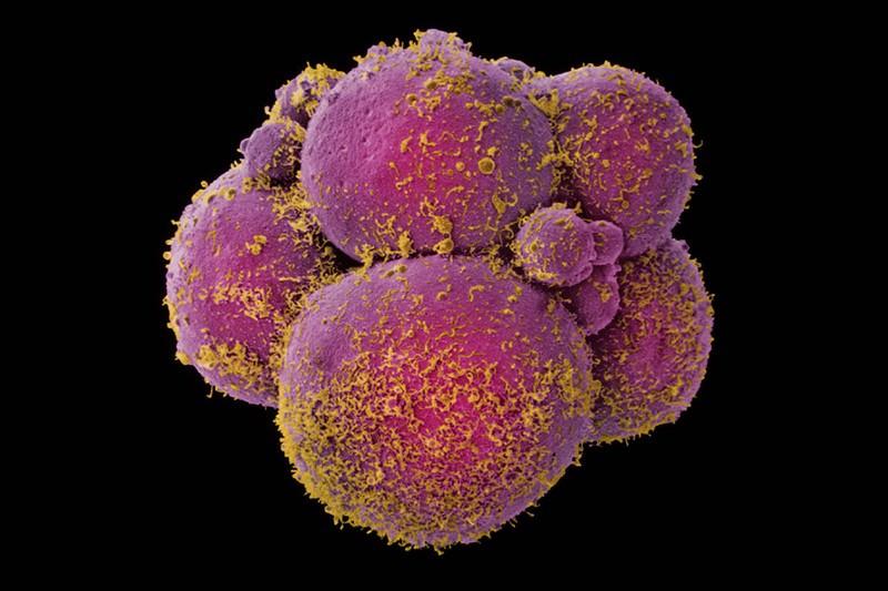 First human embryos genetically modified – more will come | New Scientist