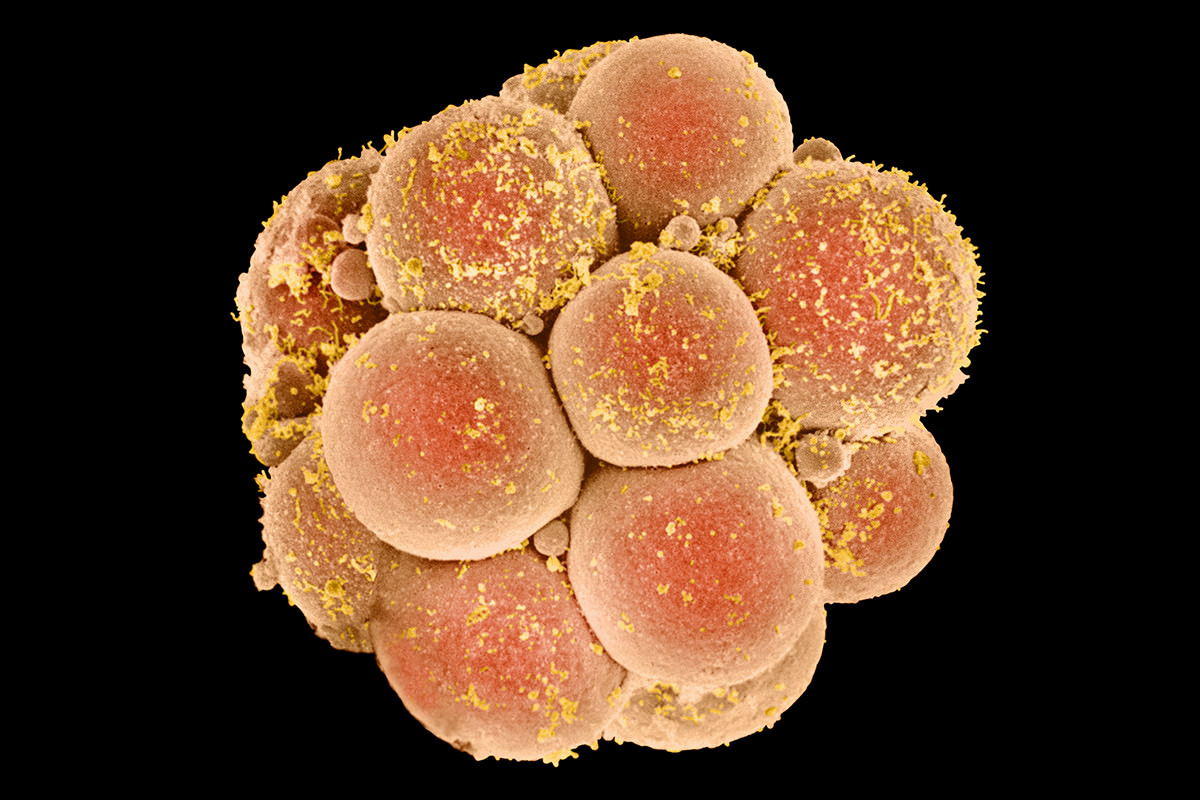 Second CRISPR Human Embryo Study Shows There Is A Long Way To Go New Second CRISPR Human Embryo Study Shows There Is A Long Way To Go New