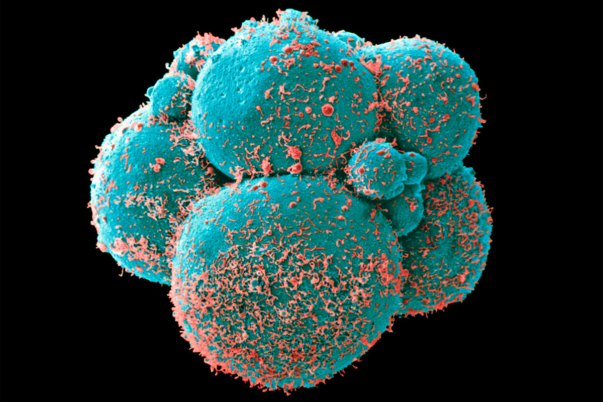 Eggs Made From Skin Cells In Lab Could Herald End Of Infertility New